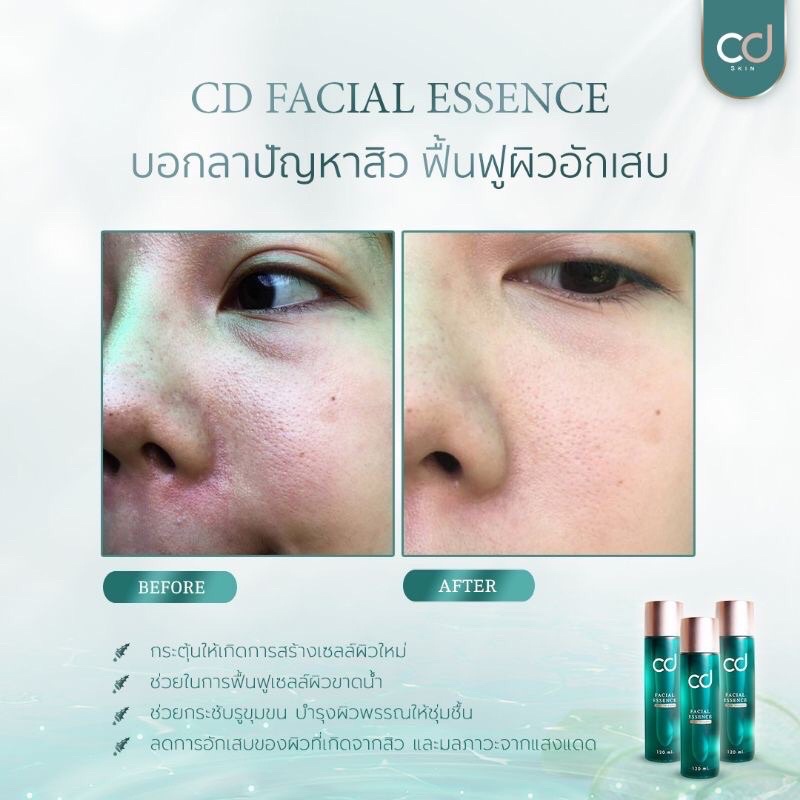 ส่งฟรีCD Facial Essence น้ำตบกุหลาบเทอร์ปีน แท้ ฟื้นฟูผิวยกกระชับ ลด ...