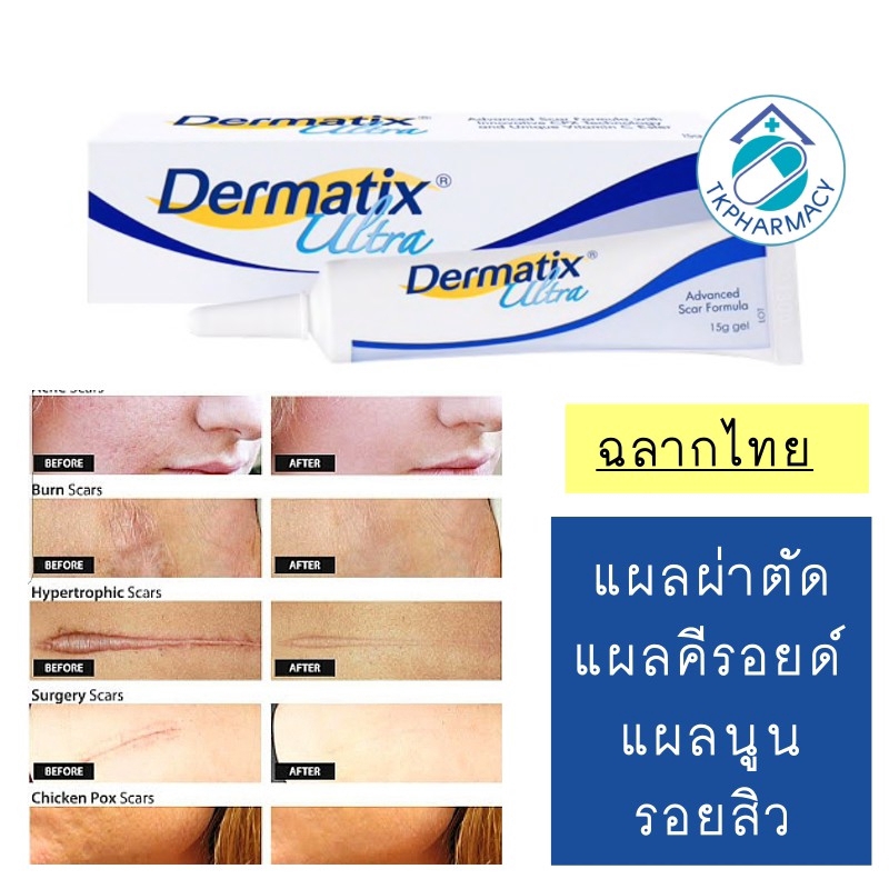 Dermatix ultra gel 5g -------------ของแท้แน่นอน พร้อมส่งค่ะ - pisan ...