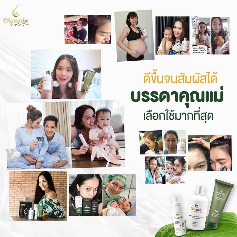 Chanada คุ้มที่สุด️ 2แถม1 ลดผมร่วง สร้างผมหนา ผมนุ่มลื่น เงางาม ส่งฟรี ...