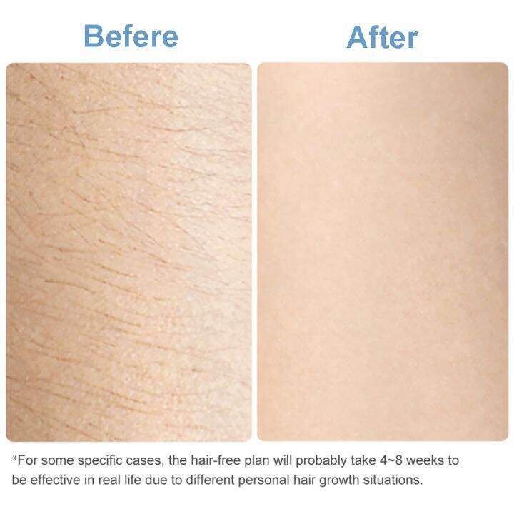 (ของแท้100พร้อมส่งจากรุงเทพ) Xiaomi inFace IPL Crystal Freezing Point ...