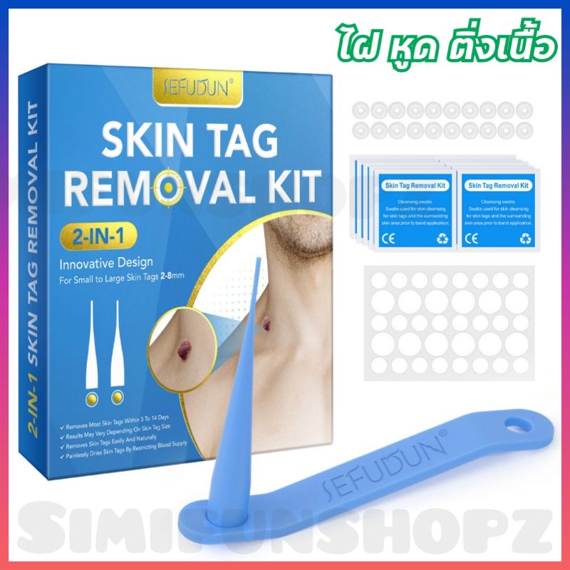 พร้อมส่งจากไทย ห่วงรัดหูด ยางรัดติ่งเนื้อ ไฝ หลุดออกอย่างง่ายดาย ...