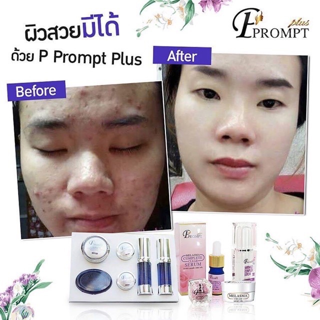 (พร้อมส่ง) P prompt plus ครีมพีพร้อมพลัส ครีมหน้าใส ไร้ฝ้า - amadboon ...