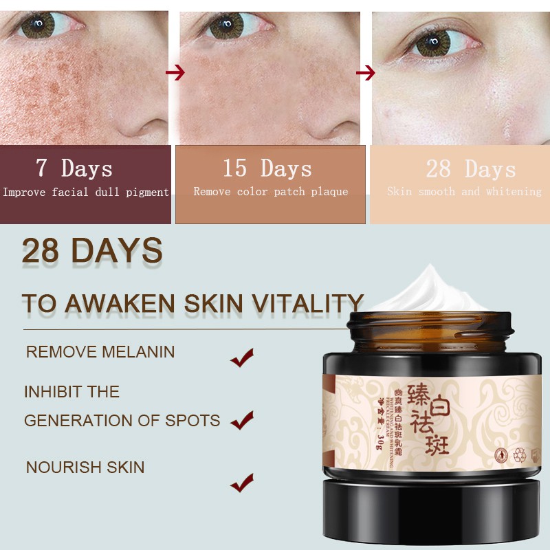 30g Skin Whitening Cream Powerful Whitening Freckle Cream Chinese ...