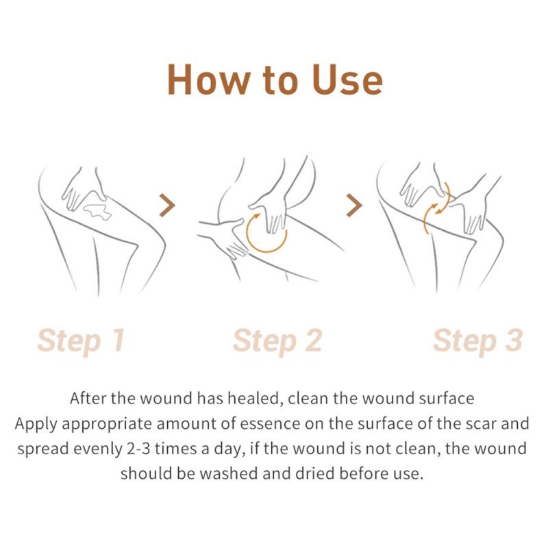  Herbal Acne Scar Mark Removal Cream Skin Spots