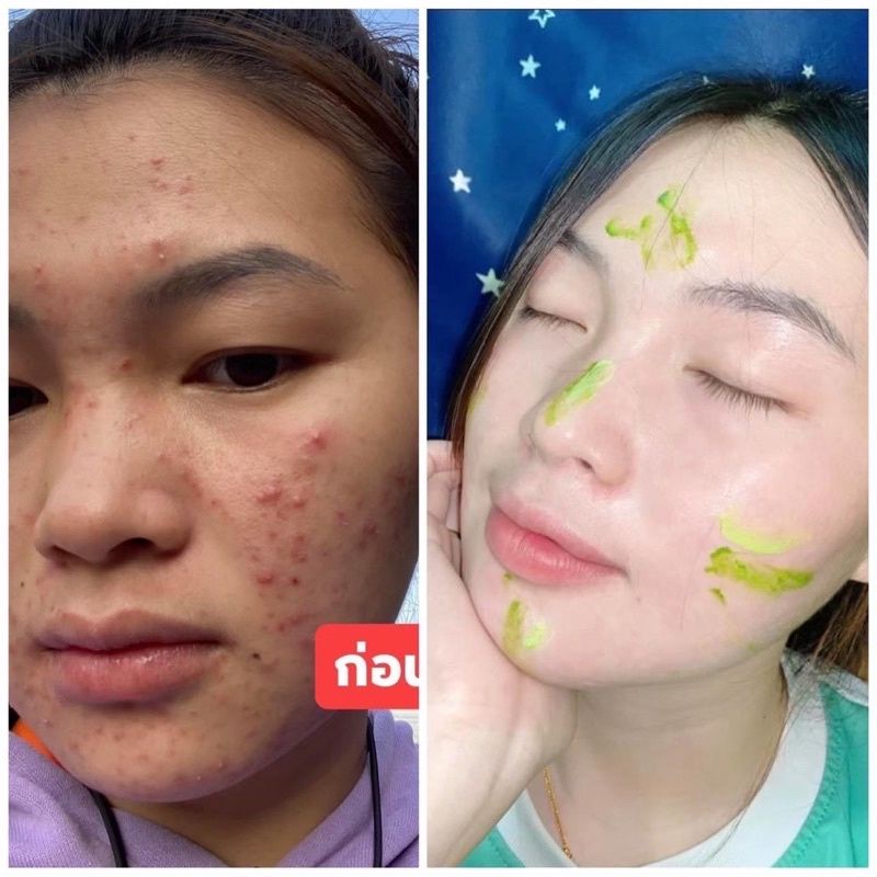 ครีมมณี ครีมmanee มณีหน้าใส ราคาเป็นชุด - atitaya7824sh - ThaiPick