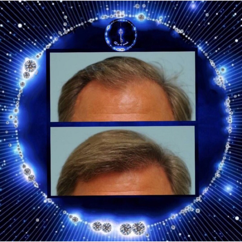 pip Minox 5 Minoxidil 5 mg - keytoyouth666 - ThaiPick