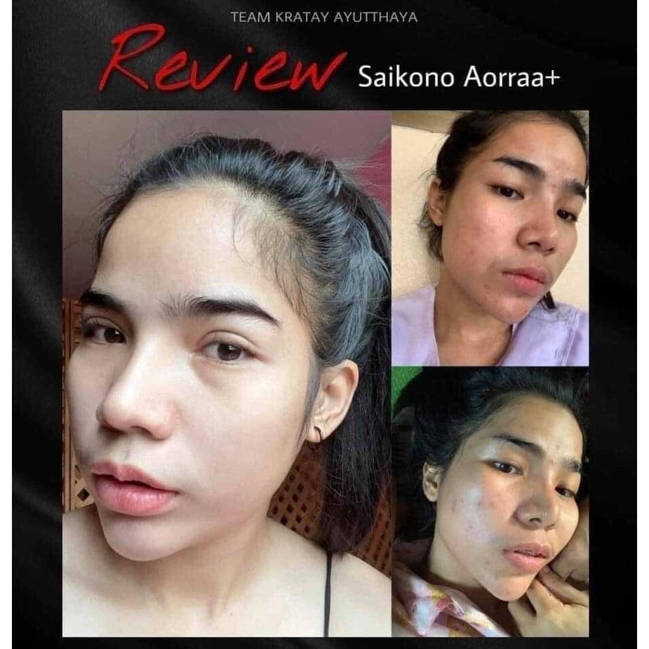 ถูก-ของแท้-ส่งไว ไม่กรีดกลูต้า คอลลาเจน ไซโกโนะ Saikono Collagen ผิวขาว หน้าใส บำรุงเล็บ ...