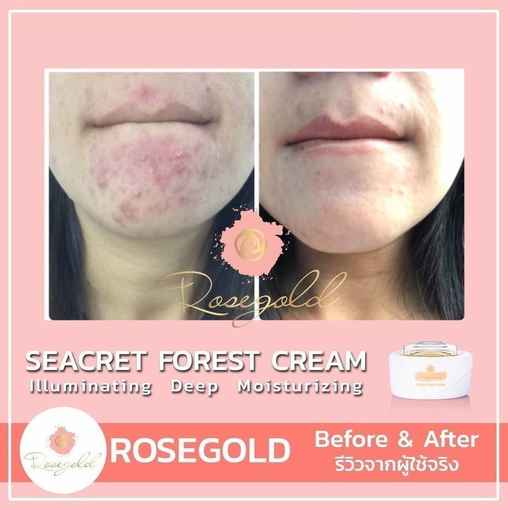 Rosegold Seacret Forest Cream ครีมบำรุงผิว บูส ผิวขาว เนียนใส มีออร่า 1 ...