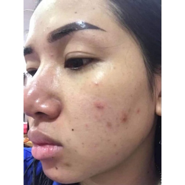 โสมไข่มุก พรทิน่า ไนท์ครีม เข้มข้นปราบฝ้าใน14วัน - pee.tipfy - ThaiPick