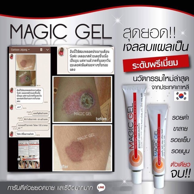 Magic Gel อ่านรายละเอียด | Shopee Thailand
