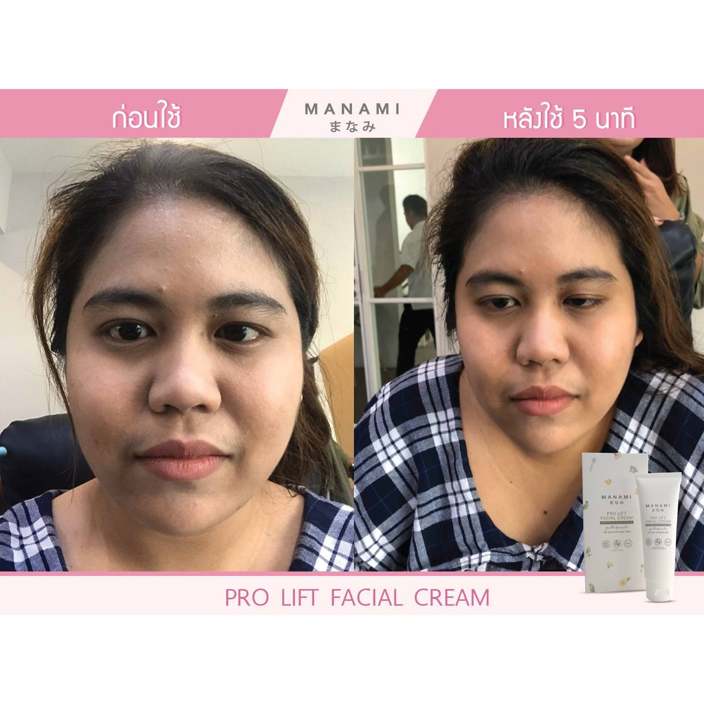 MANAMI PRO LIFT FACIAL CREAM ครีมทาหน้าเรียว ลดไขมันบนใบหน้า ยกกระชับ ...