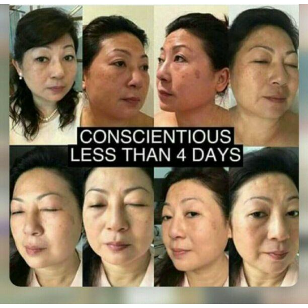 จัดส่งฟรีพร้อมส่ง Riway Purtier Conscientious สเปรย์หน้าเด้ง ฟื้นฟูผิว ...