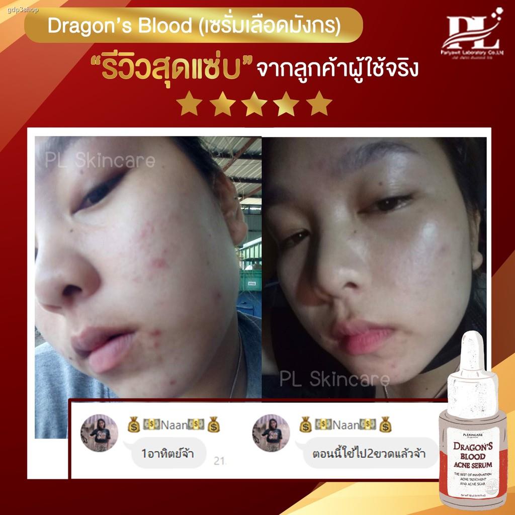 จัดส่งเฉพาะจุด จัดส่งในกรุงเทพฯเซรั่มเลือดมังกร Dragons Blood Acne ...