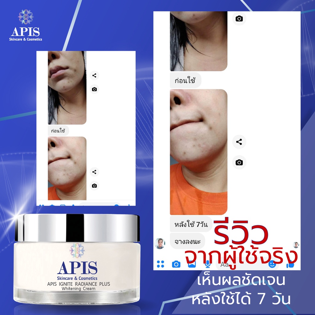 APIS Ignite Radiance Plus Whitening Cream ขนาด 30 ml. รับฟรี เซรั่มเอพิสขนาดทดลอง 1 ชิ้น ...