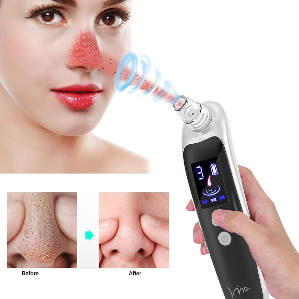USB Electric Blackheads Removal Vacuum Face Pores Cleaner Exfoliating ...