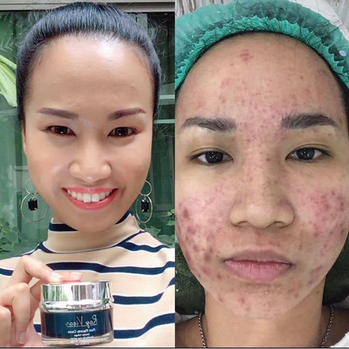 Ray viear Plant Placenta Night Cream ครีมบำรุงผิวหน้า - nuunong.shop ...