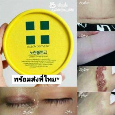 พร้อมส่ง* SALE????ครีมลบรอย Yellow Ointment Centella Treated Extract ...