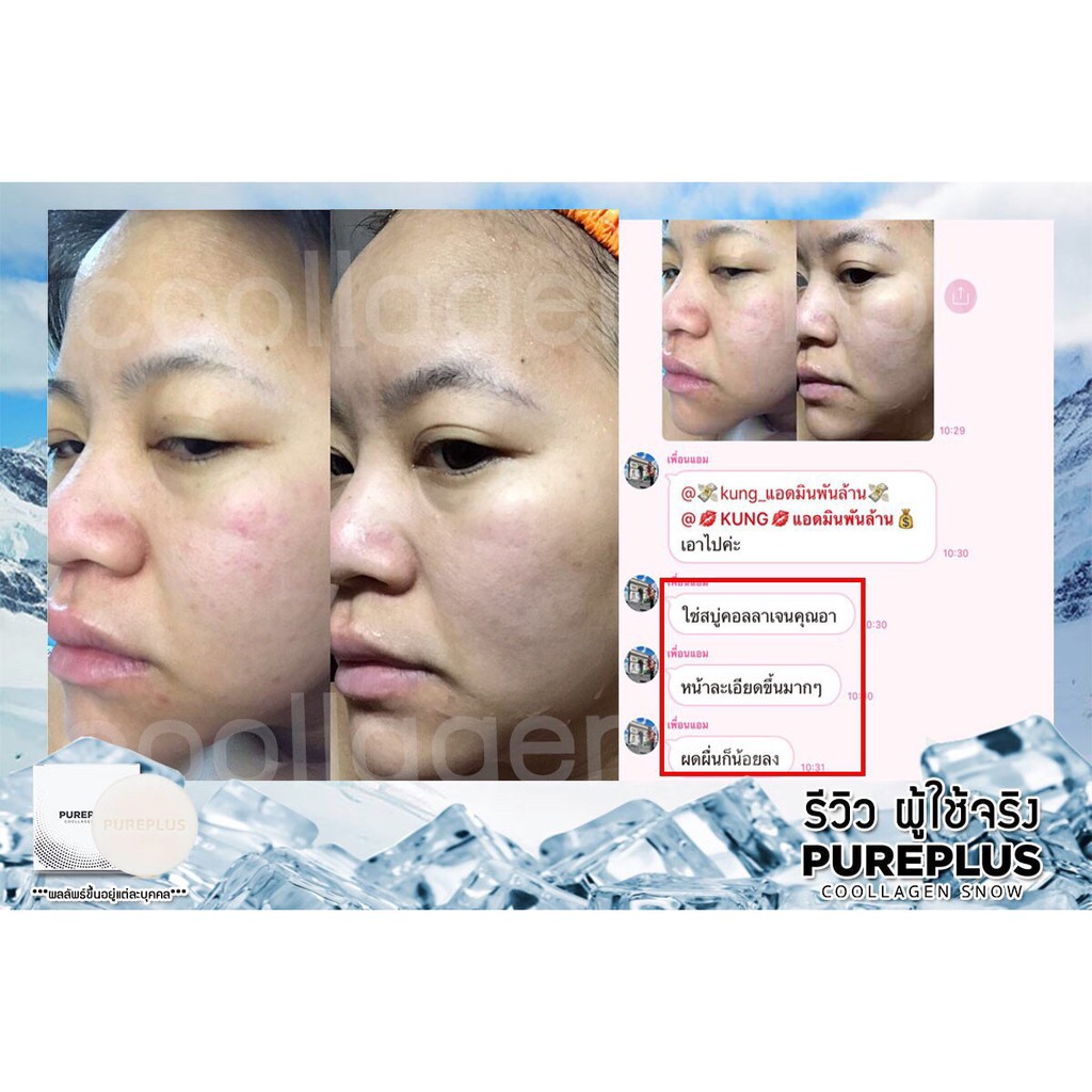 ส่งฟรี‼️ (แถมถุงตีฟอง) Pureplus Coolagen Snow แพ็ค 6 ก้อน - thanyanunrichlady - ThaiPick