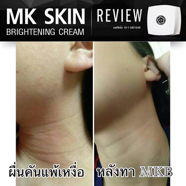 MK Skin - Brightening Cream ลืมไปเลยว่าเคยแพ้ จะหาครีมที่ช่วยฟื้นฟูผิว ...