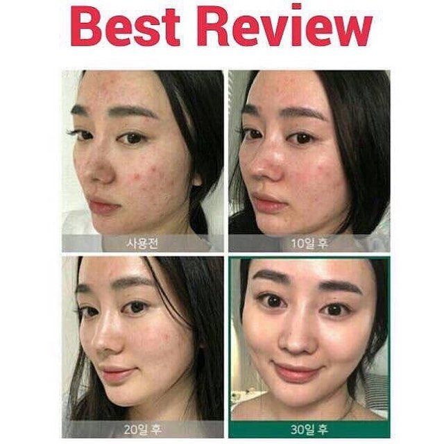 จัดส่งฟรีพร้อมส่ง Riway Purtier Conscientious สเปรย์หน้าเด้ง ฟื้นฟูผิว ...