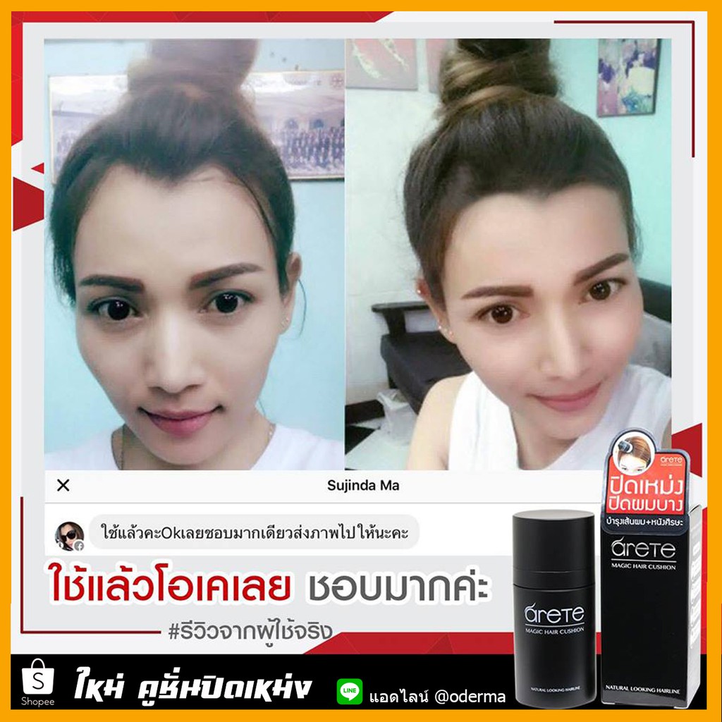 (ส่งฟรี) แฮร์คูชั่นปิดผมบาง ปิดหัวล้าน ARETE MAGIC HAIR CUSHION กันน้ำ กันเหงื่อ ล้างออกได้ด้วย ...