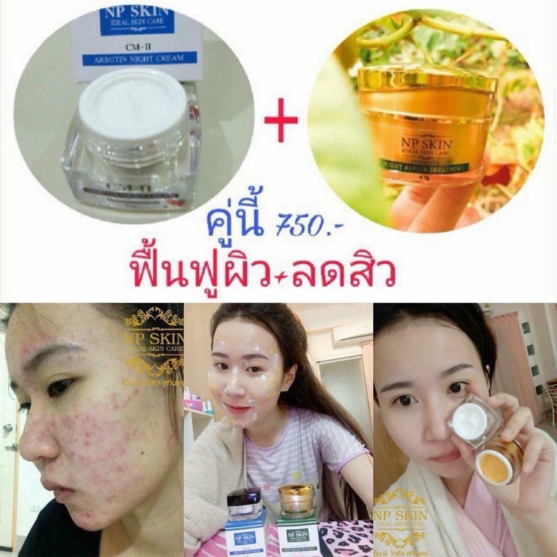 NPSKIN ครีมไนท์รีแพร์+CM ll คู่นี้ส่งฟรี????มีบริการเก็บเงินปลายทาง ของแท้???? - fh.shop53 ...