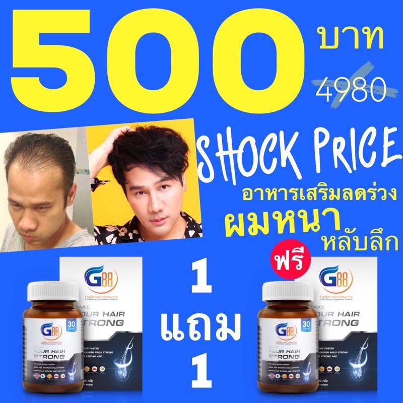 G88 จีแปดแปด ผลิตภัณฑ์เสริมอาหาร บำรุงรากผม ปลูกผม แก้ผมร่วง (ของแท้ ...