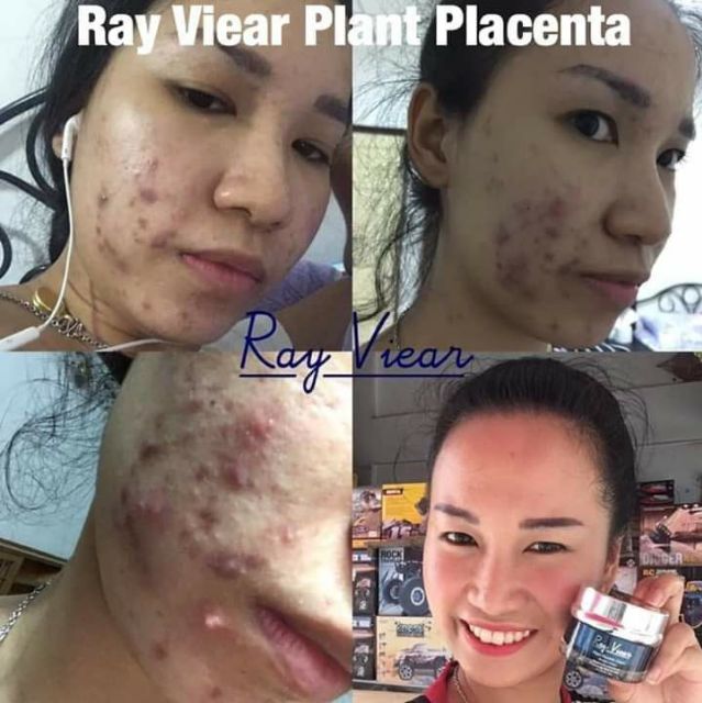 ส่งฟรี Ray Viear Plant Placenta Cream - vinnara - ThaiPick