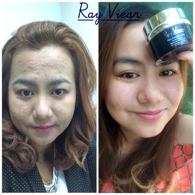 Ray Viear plant placenta Night cream เรเวียร์ แพลนท์ พลาเซนตา ...