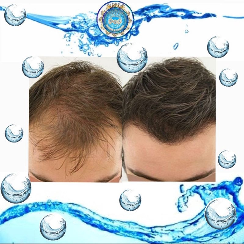 Finasteride1mg harifinแฮริฟิน 1 mg. 1 กล่อง 30 เม็ด - popup99 - ThaiPick