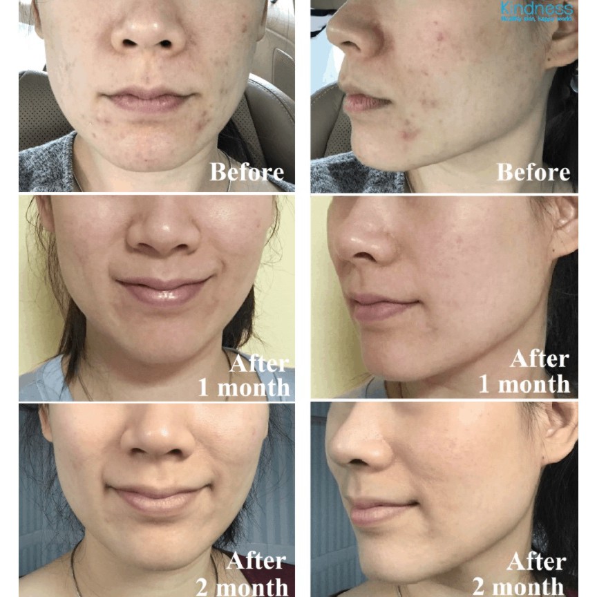 โล๊ะสต๊อก Kindness Happy Glow ครีมบำรุงผิวหน้า Moisturizer 30ml (Old ...