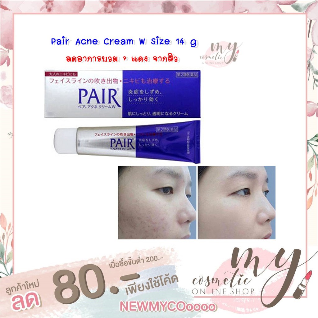 Pair Acne Cream W ขนาด 14g. ครีมทาสิว ยุบเร็ว สิวอักเสบ - piano.ponia ...