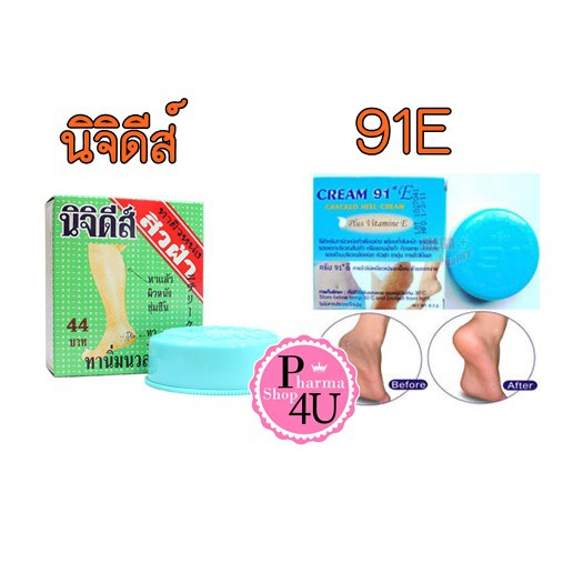ครีมทาส้นเท้าแตก นิจิดีส์ ครีมทาผิวหนัง 15.3G / Cream 91E ทาส้นเท้าแตก ...