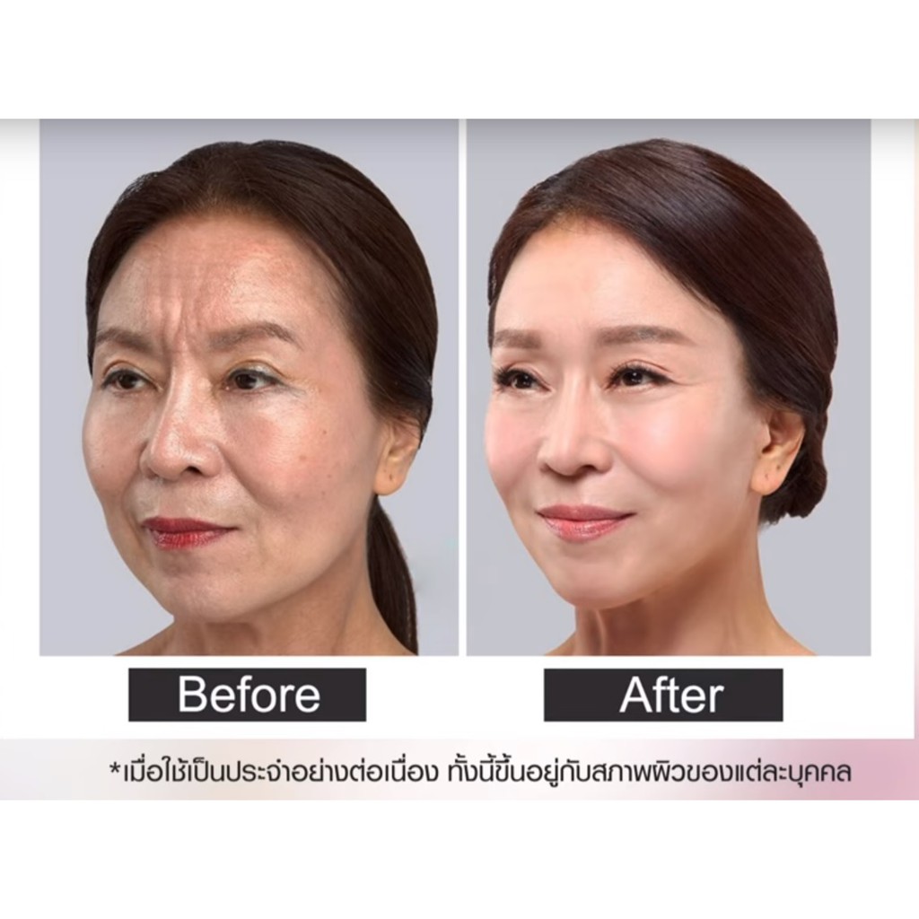 CHUO Snail Mucus Anti-Wrinkle Serum (30 ml.) CHUO Snail Mucus Intensive ...