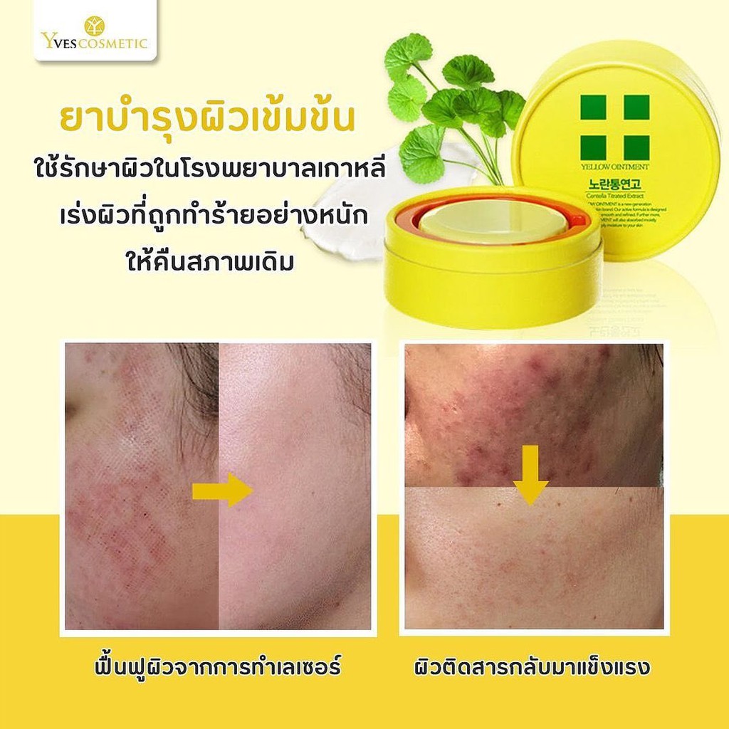 พร้อมส่งด่วน ส่งฟรี Yellow Ointment Centella treated Extract 18 g. ครีม ...
