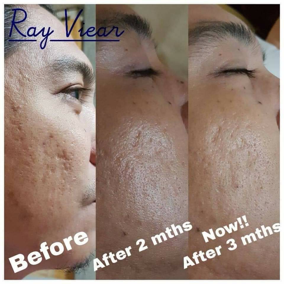 Ray Viear Plant Placenta Cream (เรเวียร์ แพลนต์ พลาเซนต้า ครีม ขนาด 30 ...