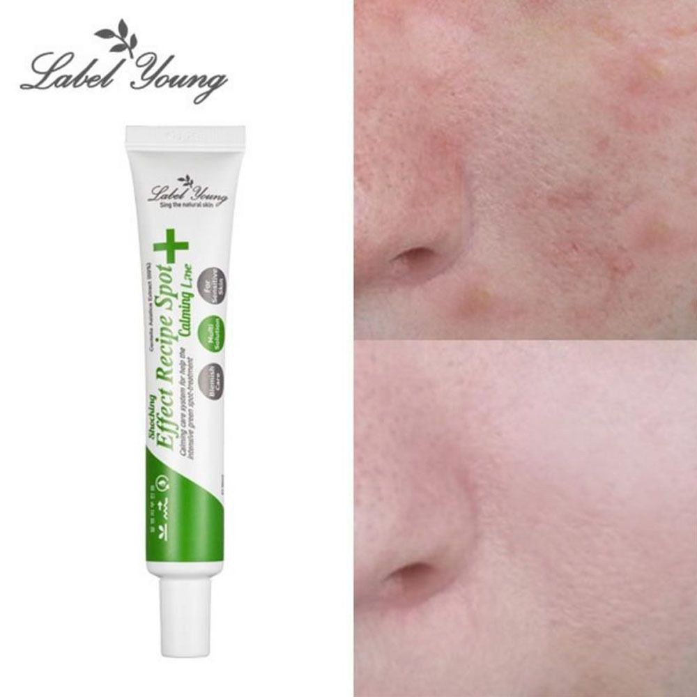 (ส่งฟรี) (Set 2) Label Young มาส์กสมุนไพรรักษาสิว 1 กระปุก Label Young ...