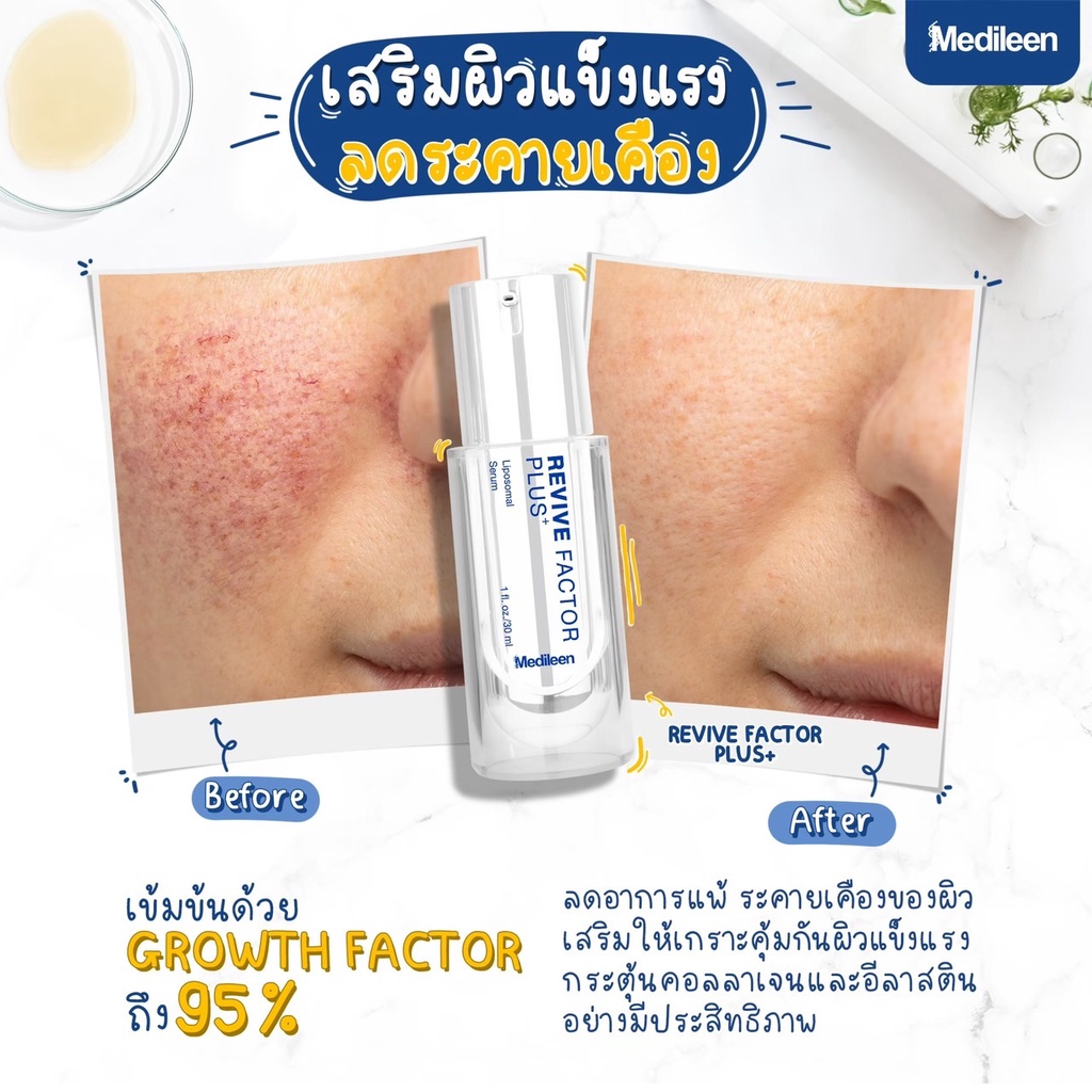 Medileen SETผิวคุณจุ๊บจิ๊บ ฟรีเทสเตอร์️สะสมคะแนน เมดิลีน ครีมหน้าใส ...
