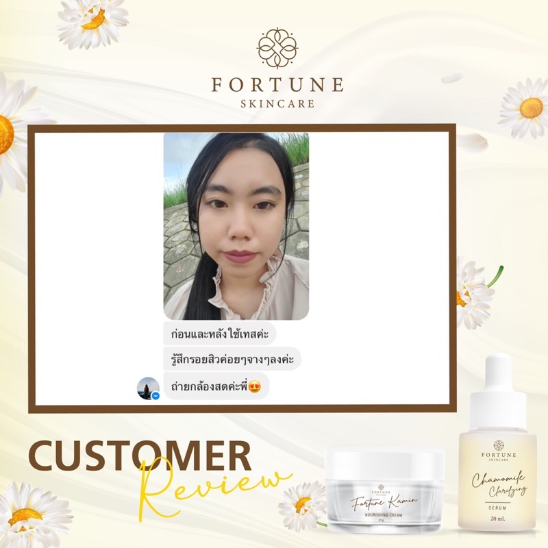 เซรั่มคาร์โมมายด์ลดสิวส่งฟรี - thebestskincare.99 - ThaiPick
