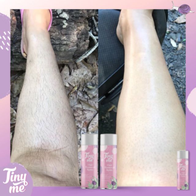 ของแท้ - มูสกำจัดขน - Tinyme ขนหายแค่ 5 นาที - primopinkshop - ThaiPick