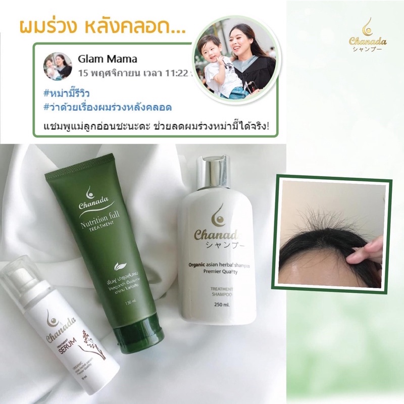 Chanada คุ้มที่สุด️ 2แถม1 ลดผมร่วง สร้างผมหนา ผมนุ่มลื่น เงางาม ส่งฟรี ...