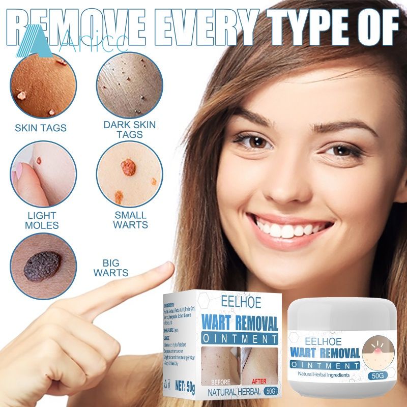 Genital Warts Removal