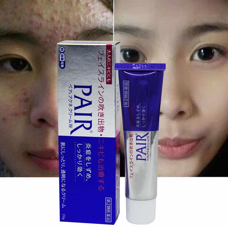 Lion PAIR Acne Cream W 14g. - beautykorea_th - ThaiPick