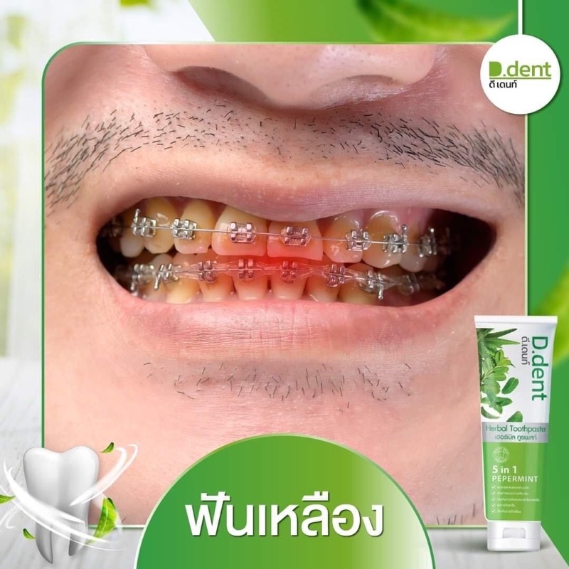 1แถม1 D.dent 100g.ยาสีฟันดีเดนท์ ยาสีฟันสมุทรไพร ลดกลิ่นปาก ฟันขาว ปวด ...