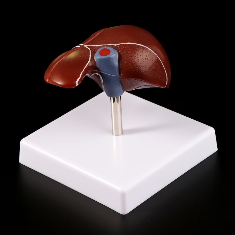 GOO Human Liver Pathological Anatomical Model Anatomy School Medical ...
