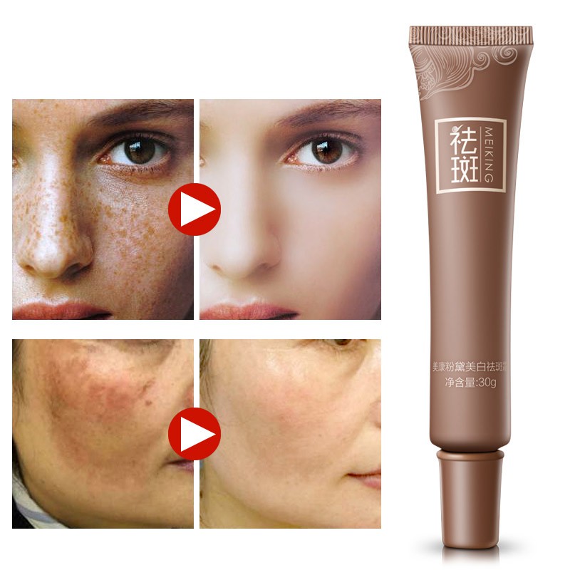 Meiking Lightening Blemish Removal Serum Reduces Freckles Face Cream ...