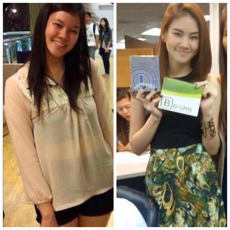 bhip บีกรีน BGRN ดีทอคซ์ ล้างลำไส้ ลดพุง ปลอดภัย 100% ส่งฟรีทั่วไทย ...