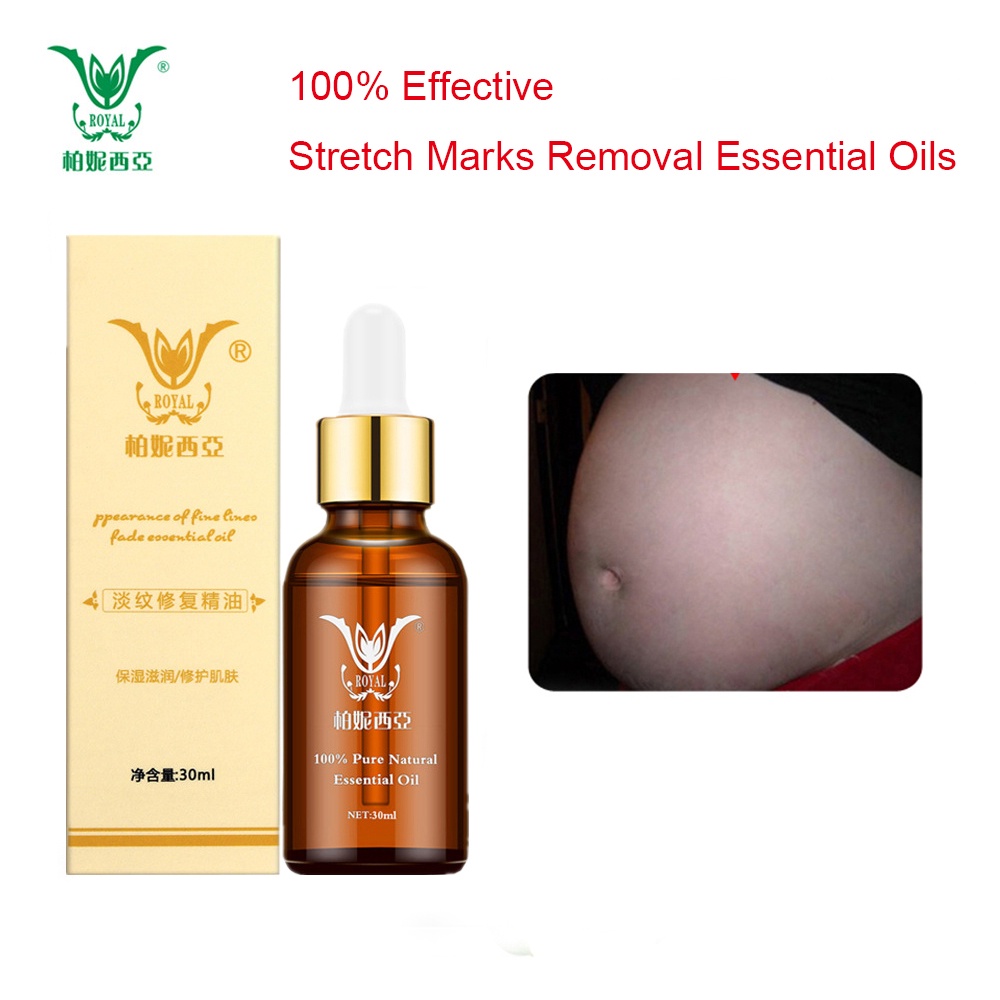 ซ่อมแซมหลังคลอด 30ml Stretch Marks Removal Essential Oils Pure Natural ...