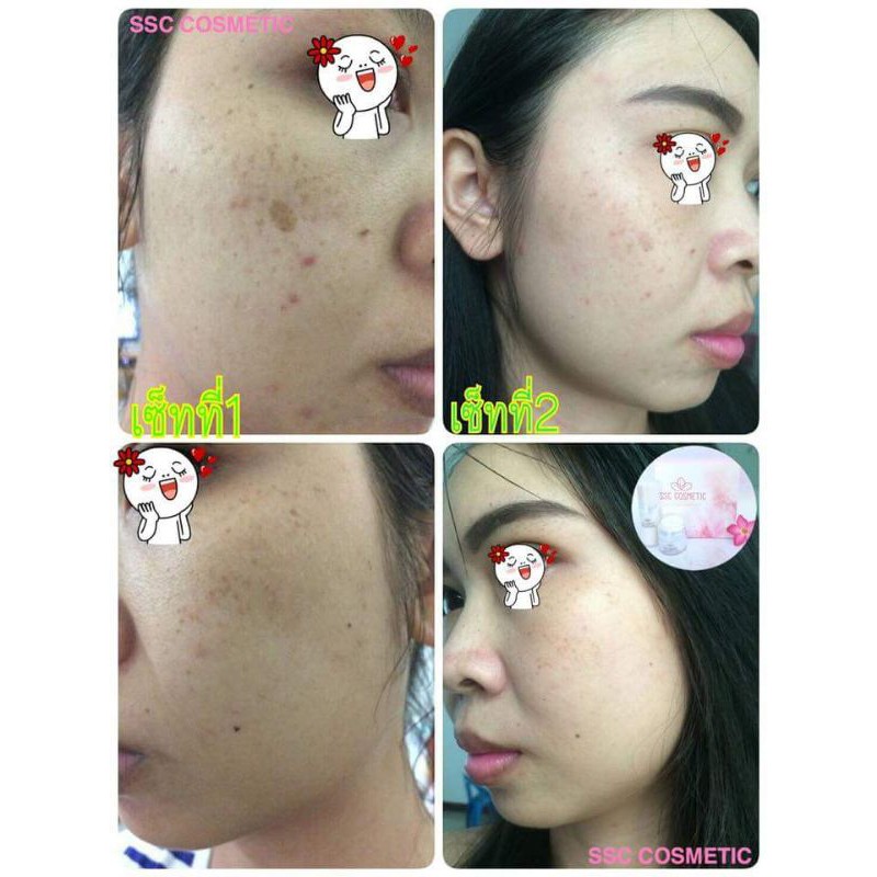 SSC Cosmetic มีของแถมครีมทาฝ้า Skin Melasma Cream 15 g. White Gold ...