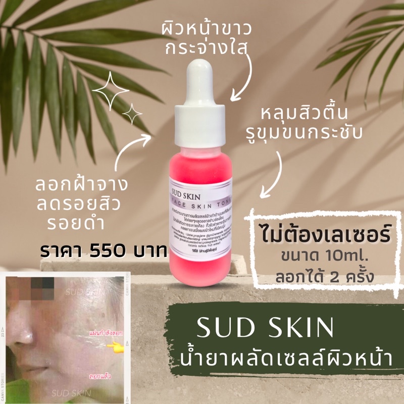 Gentrex cream ทาแผลสด ไม่แสบ ฆ่าเชื้อ ป้องกันแบคทีเรีย - young_pink ...